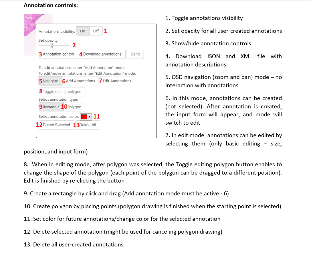 GitHub - cesekova/openseadragon_fabric_annotations: Openseadragon ...